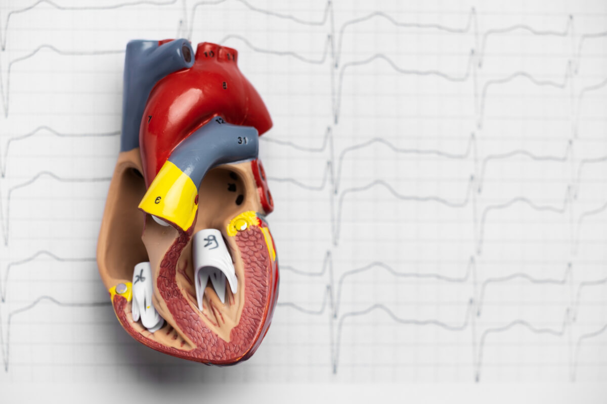 ¿Qué es la arritmia cardíaca? | Boskis Grupo Cardiológico